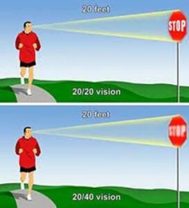 What does legally blind look like? - Dr Denise M Robinson