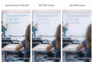 What does 20/100 vision look like? | Dr Denise M Robinson