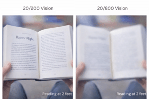 What does 20/800 vision look like? | Dr Denise M Robinson